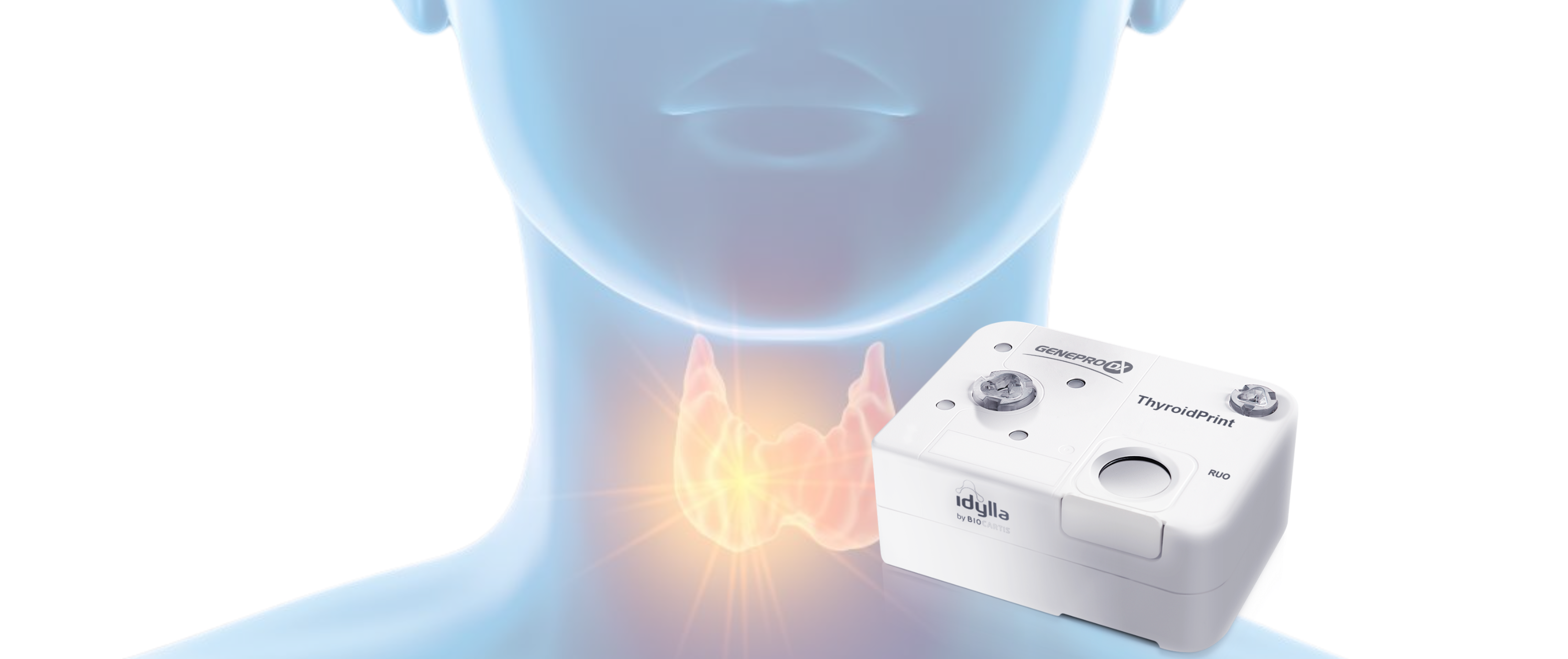 Idylla ThyroidPrint® Assay | Biocartis